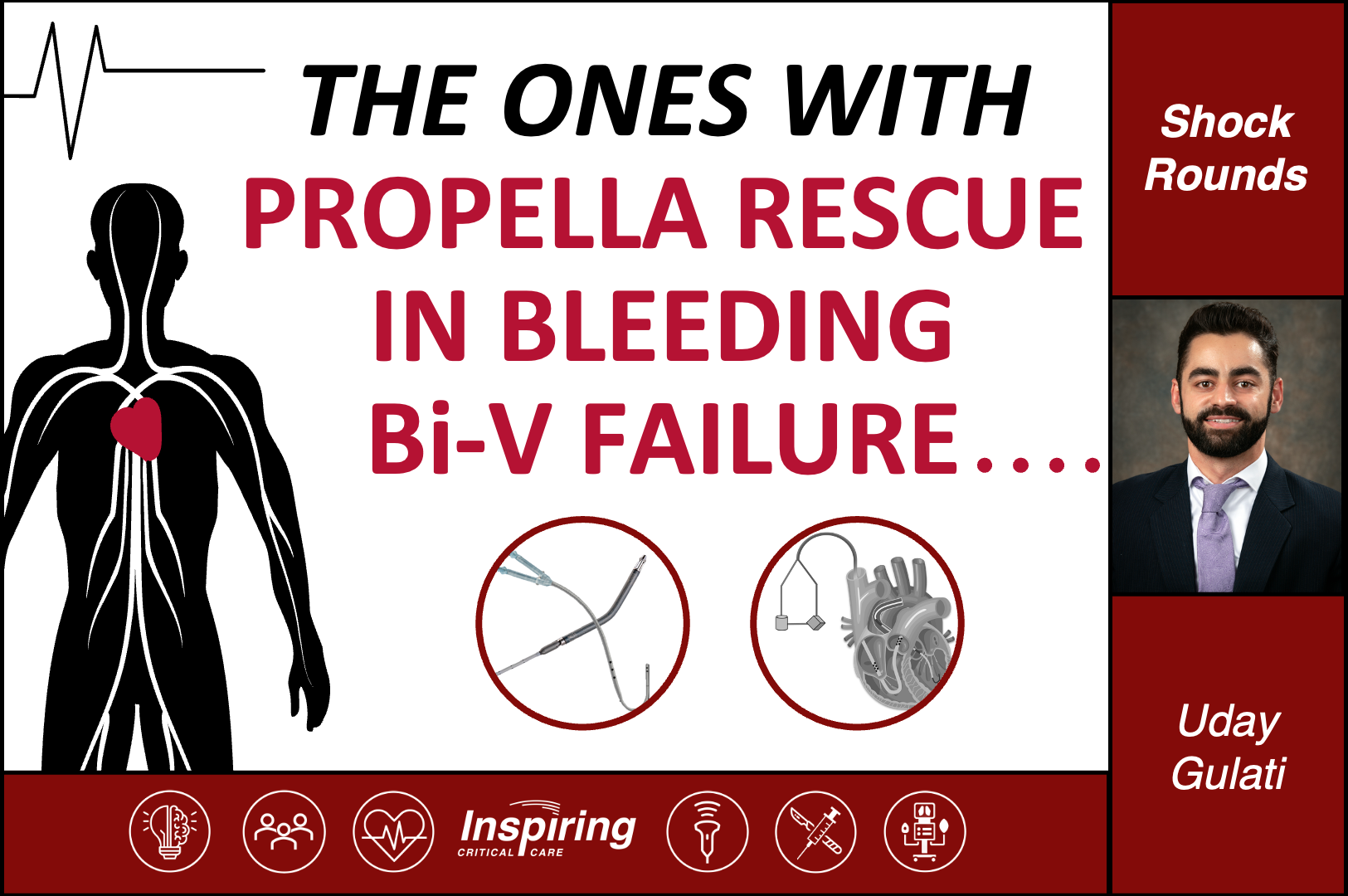 The Ones with Propella Rescue in Bleeding Bi-V Failure – Gulati ...